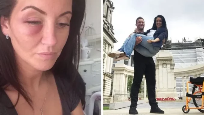 This Brave Woman Claims That Having A Stroke Was The Best Thing That ...